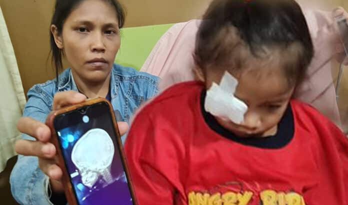 Korban Penembakan Medan Belawan, Mata Bocah 4 Tahun Masih Bersarang ...
